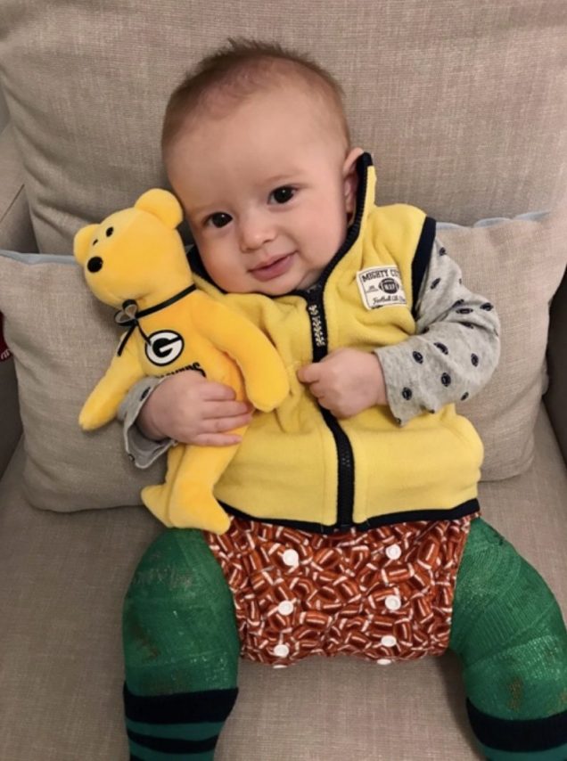 Hip dysplasia care + tips - Bumblebaby
